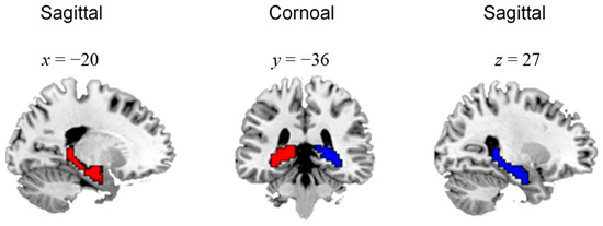 Hippocampus Parcellation via Discriminative Embedded Clustering of fMRI ...