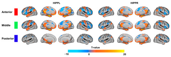 Hippocampus Parcellation via Discriminative Embedded Clustering of fMRI Functional Connectivity