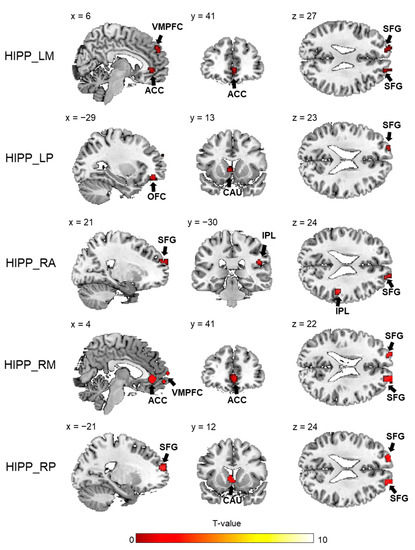 Hippocampus Parcellation via Discriminative Embedded Clustering of fMRI ...