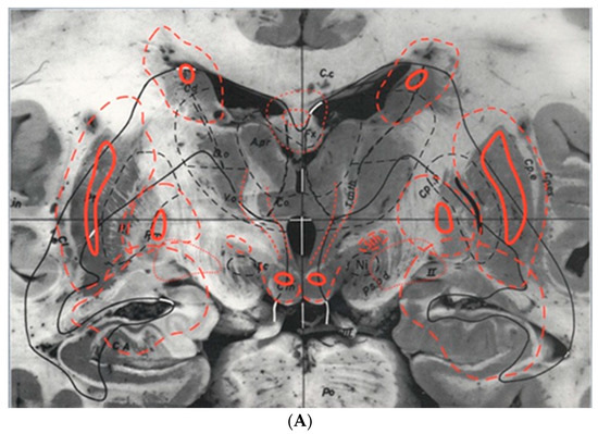 A Brief History of Stereotactic Atlases: Their Evolution and Importance ...