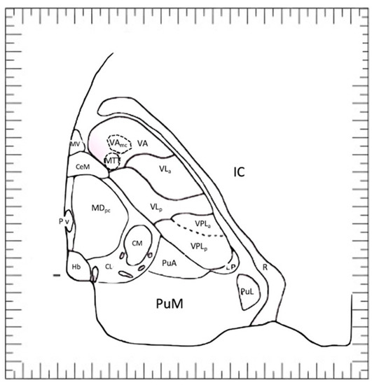 A Brief History of Stereotactic Atlases: Their Evolution and Importance ...