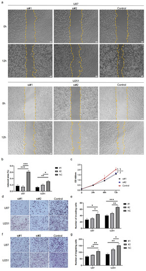 High ECM2 Expression Predicts Poor Clinical Outcome and Promotes the ...
