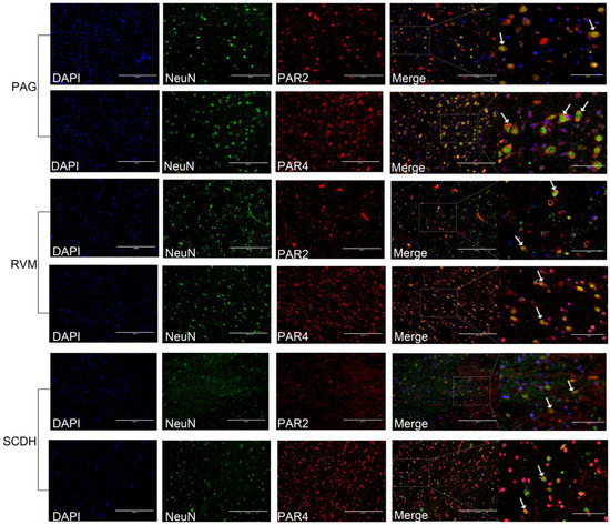 Electroacupuncture Relieves Visceral Hypersensitivity via Balancing ...