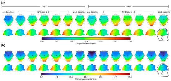 Modulating Individual Alpha Frequency through Short-Term Neurofeedback ...