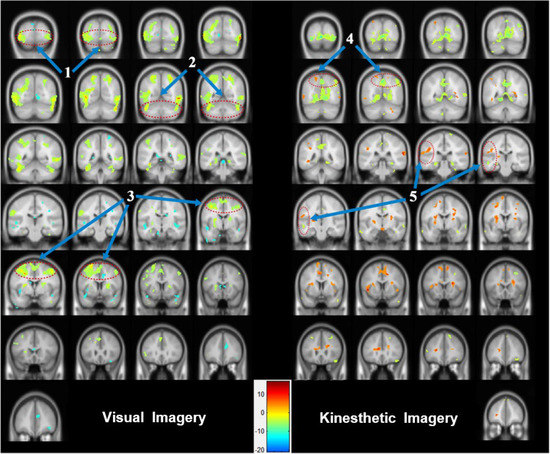 Neuropsychological Activations and Networks While Performing Visual and ...