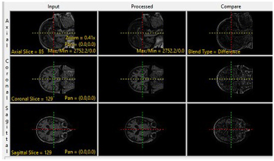 Pareto Optimized Adaptive Learning with Transposed Convolution for ...