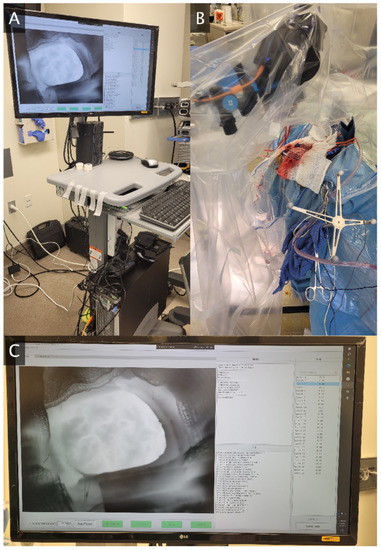 A Novel Intraoperative Mapping Device Detects the Thermodynamic ...