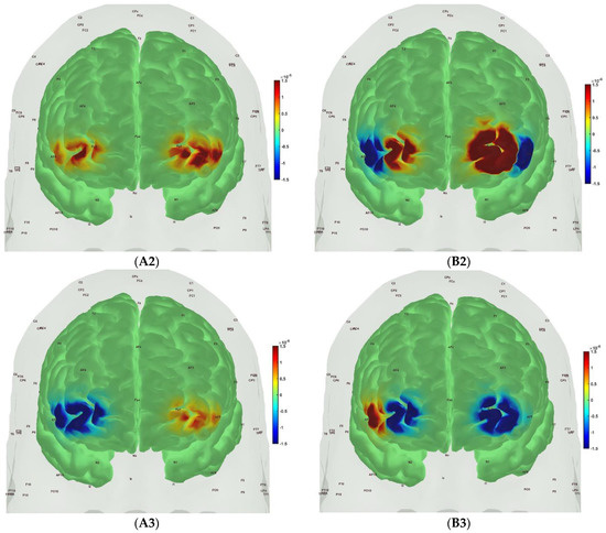 Operational Modal Analysis of Near-Infrared Spectroscopy Measure of 2 ...
