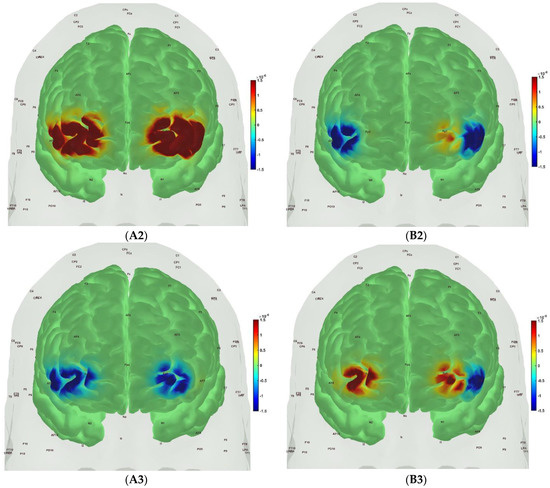 Brain Sciences | Free Full-Text | Operational Modal Analysis of Near-Infrared Spectroscopy ...