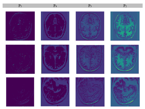 Fully Automated Skull Stripping from Brain Magnetic Resonance Images Using Mask RCNN-Based Deep ...