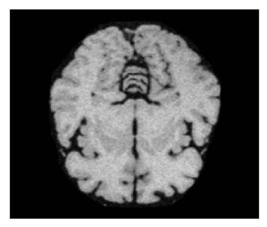 Fully Automated Skull Stripping from Brain Magnetic Resonance Images Using Mask RCNN-Based Deep ...