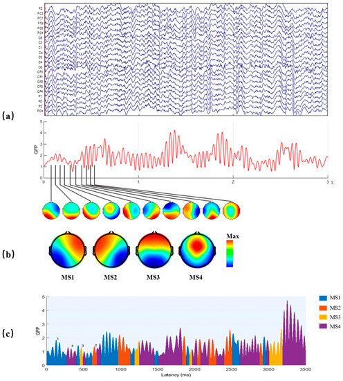 Predicting Motor Imagery BCI Performance Based on EEG Microstate Analysis