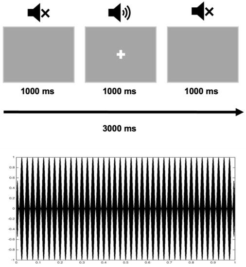 Event-Related Desynchronization of MEG Alpha-Band Oscillations during ...