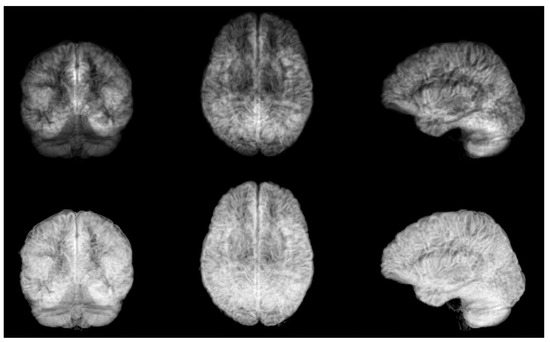 Efficient Brain Age Prediction from 3D MRI Volumes Using 2D Projections