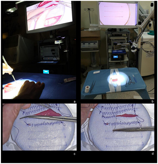 Assessing the Training in Neurosurgery with the Implementation of VITOM ...