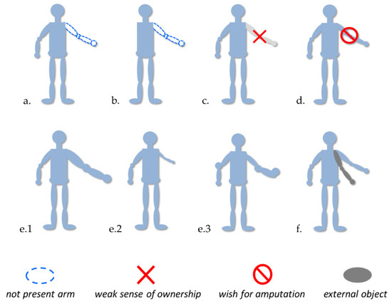 An Overview of the Body Schema and Body Image: Theoretical Models ...