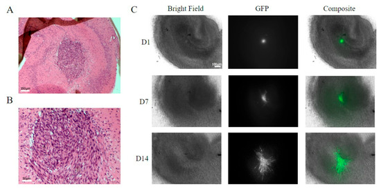 An In Vitro Brain Tumour Model in Organotypic Slice Cultures Displaying ...