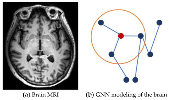 The Combination of a Graph Neural Network Technique and Brain Imaging ...