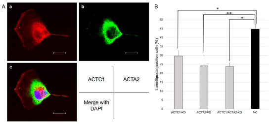 Actin Alpha 2, Smooth Muscle (ACTA2) Is Involved in the Migratory ...