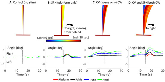 The Effect of Roll Circular Vection on Roll Tilt Postural Responses and ...
