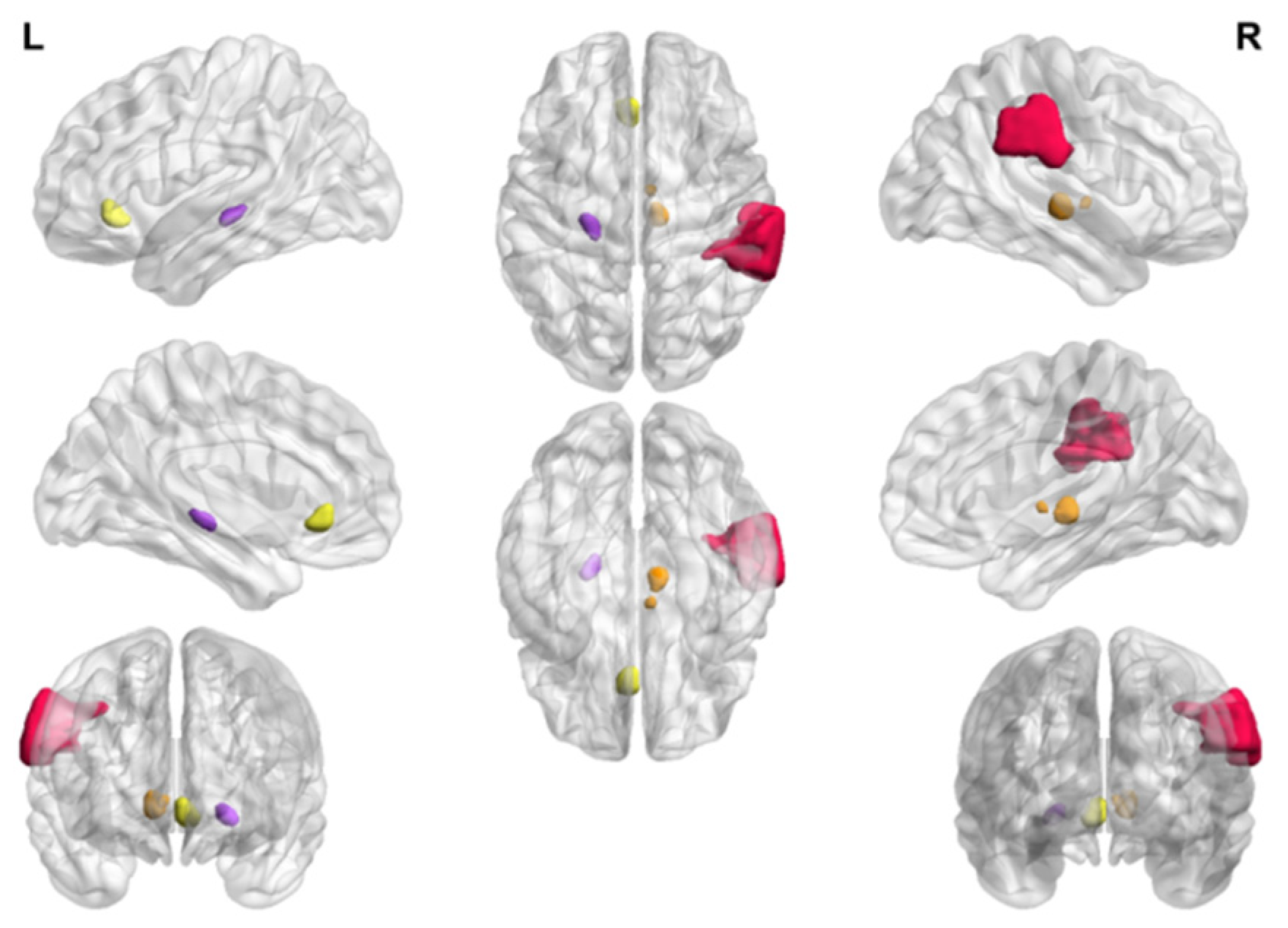 Auto-Classification of Parkinson’s Disease with Different Motor ...