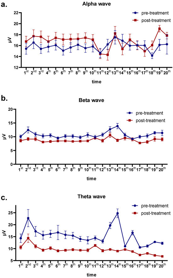 EEG Biofeedback Decreases Theta and Beta Power While Increasing Alpha ...