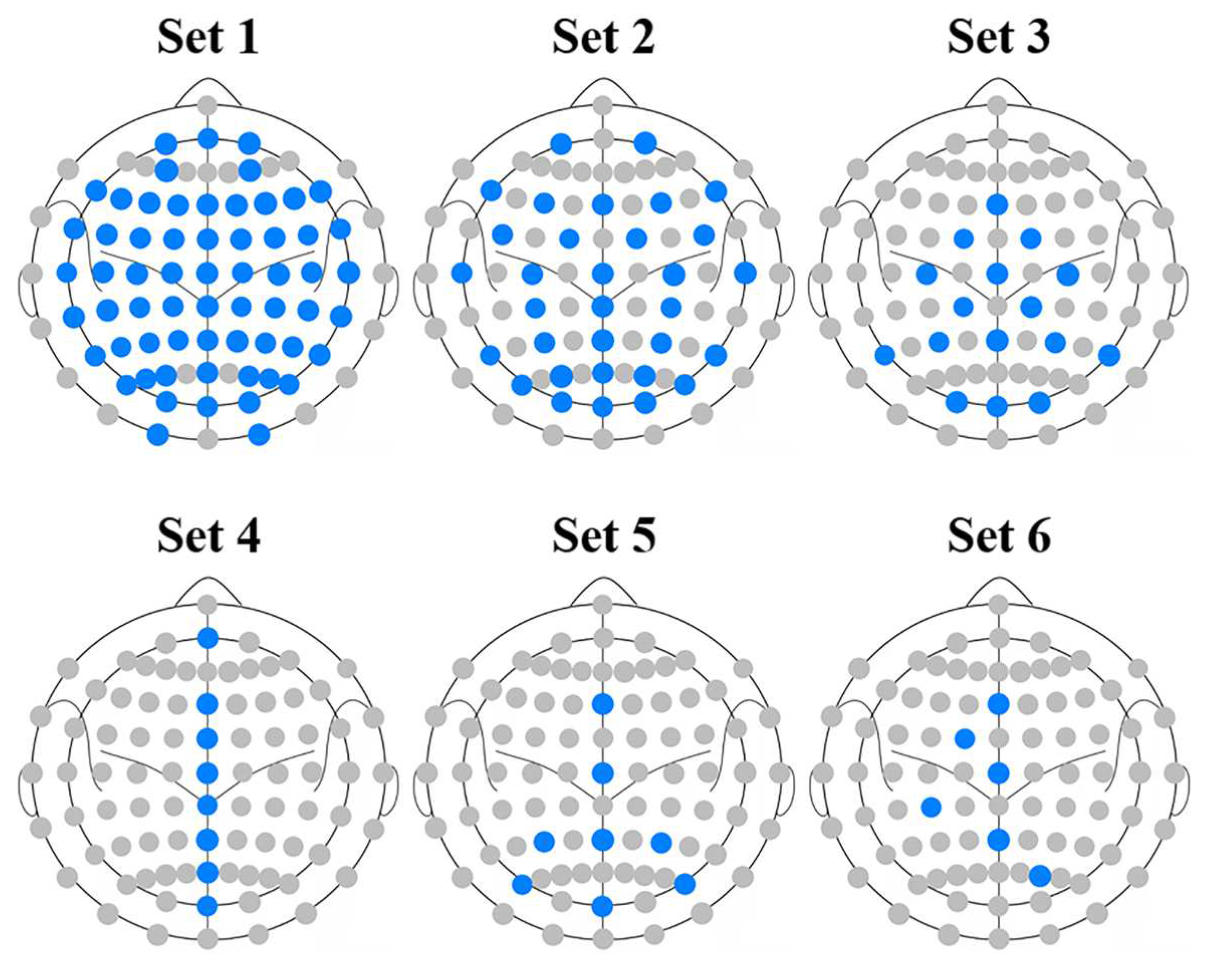 Brain Sciences | Free Full-Text | EEG-Based Target Detection Using an RSVP Paradigm under Five ...