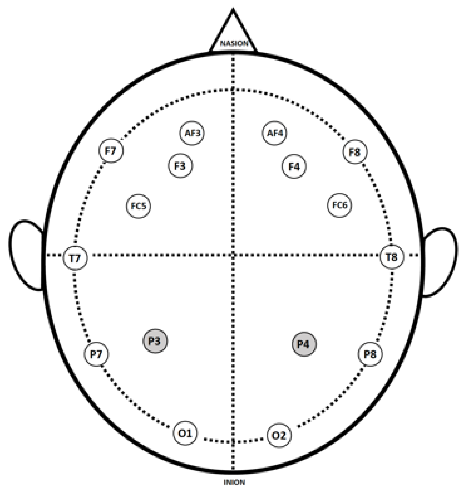 Neurocognitive Correlates of Clinical Decision Making: A Pilot Study ...