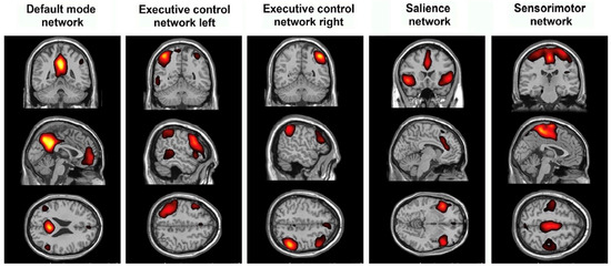 Epilepsy Networks and Their Surgical Relevance