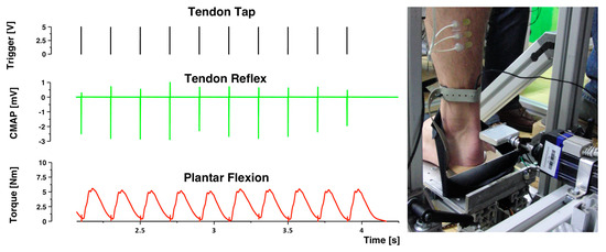 Sensory Stimulation of the Triceps Surae Muscle Complex Modulates ...