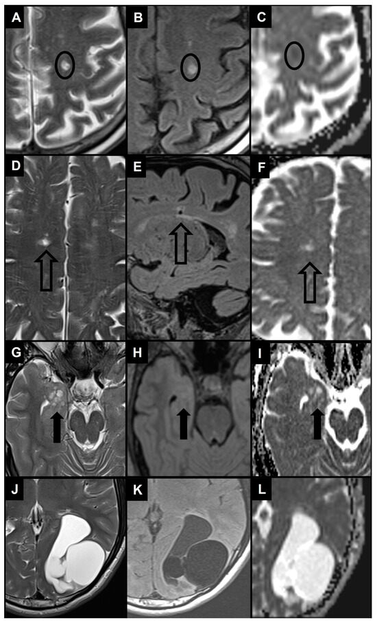 Overview of the Current Knowledge and Conventional MRI Characteristics ...