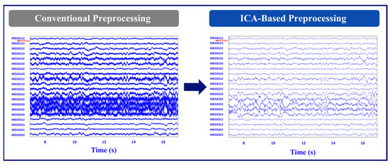 Brain Sciences | Free Full-Text | Magnetoencephalography (MEG) Data ...