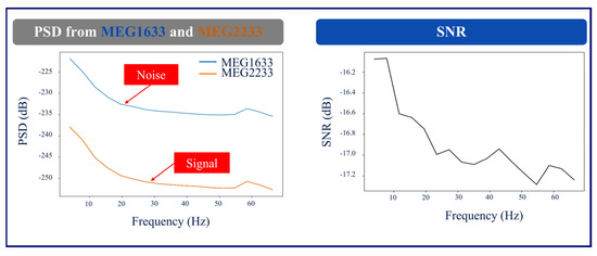 Magnetoencephalography (MEG) Data Processing in Epilepsy Patients with ...