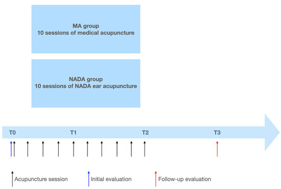 Ear Acupuncture Points For Pain NADA Ear Acupuncture And Medical