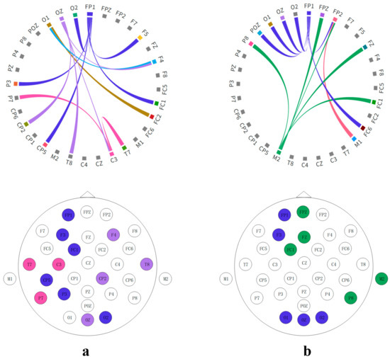 Brain Sciences | Free Full-Text | Exploring Brain Dynamics via EEG and Steady-State Activation ...