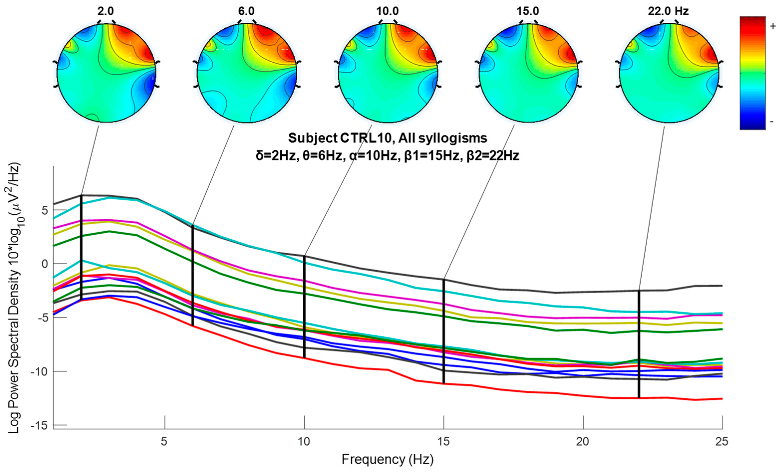 Using Electroencephalogram-Extracted Nonlinear Complexity and Wavelet-Extracted Power Rhythm ...