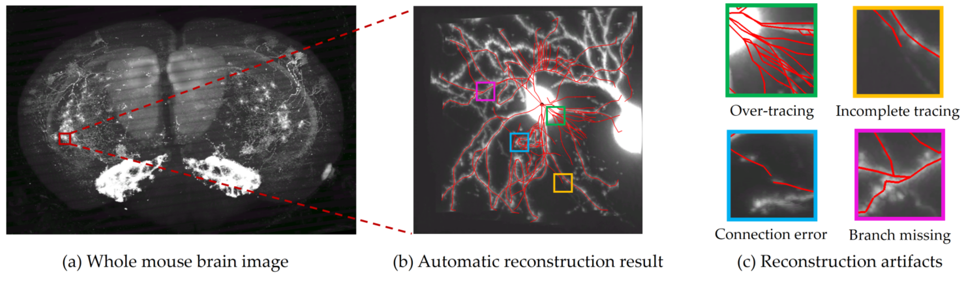 Brain Sciences | Free Full-Text | Complete Neuron Reconstruction Based ...