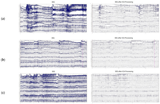 A Hybrid EEG-Based Stress State Classification Model Using Multi-Domain ...
