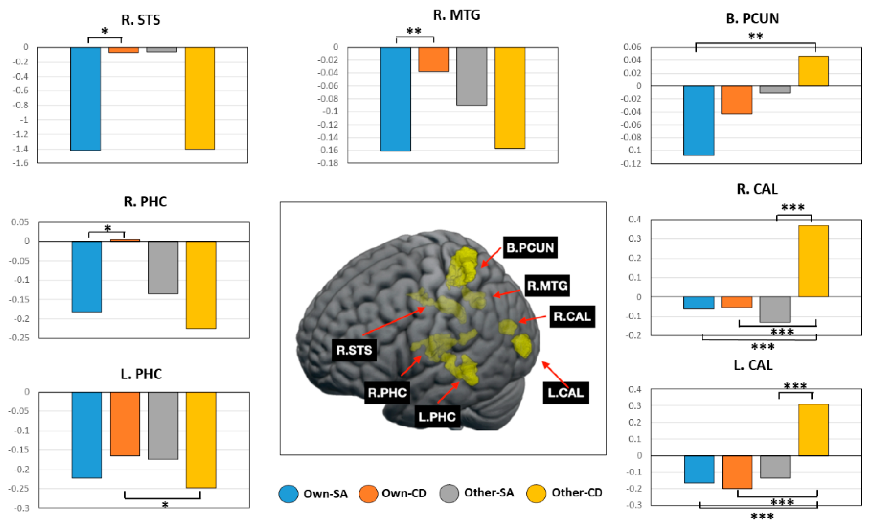 Neural Effects of One’s Own Voice on Self-Talk for Emotion Regulation
