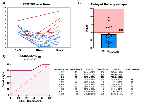 Rebound Tremor Frequency as a Potential Diagnostic Marker for Delayed ...