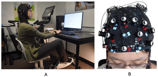Hyperactivity in ADHD: Friend or Foe?