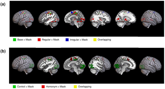 Neural Dynamics of Processing Inflectional Morphology: An fMRI Study on ...