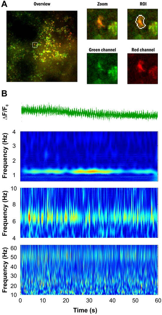 FluoAnalysis: An Open-Source MATLAB Toolbox for Analysis of Calcium Imaging Measurements of ...