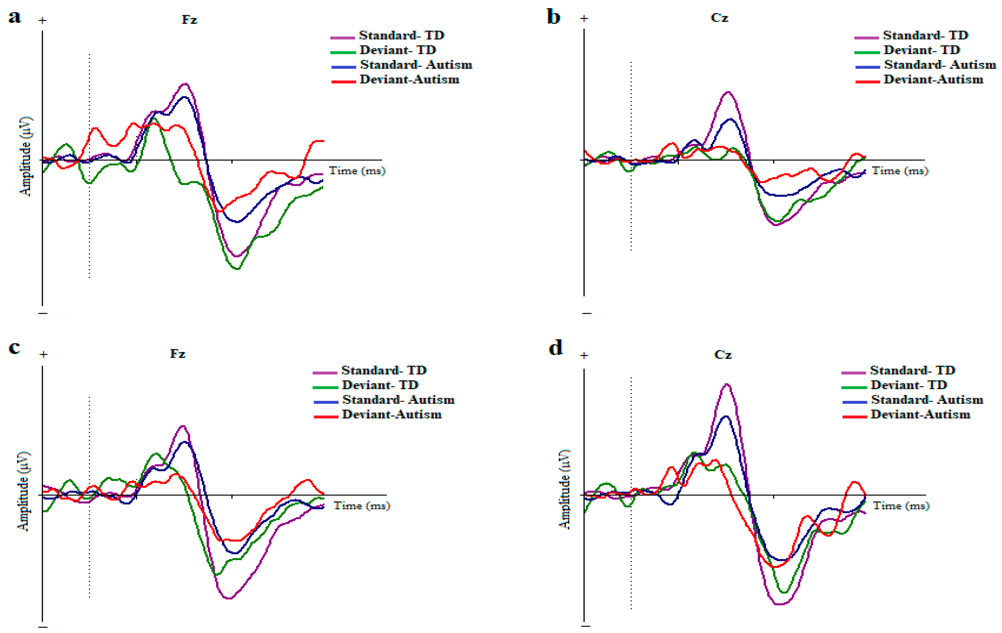 Early Auditory Temporal Processing Deficit in Children with Autism ...