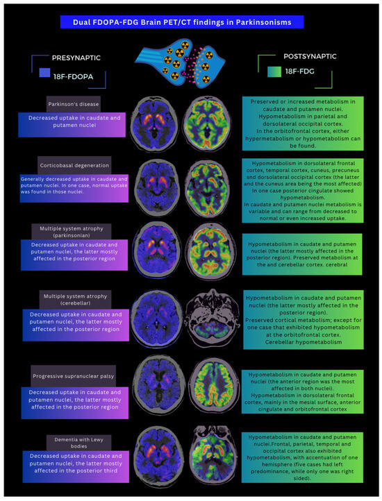Brain Evaluation by Dual PET/CT with [18F] FDOPA and [18F] FDG in Differential Diagnosis of ...
