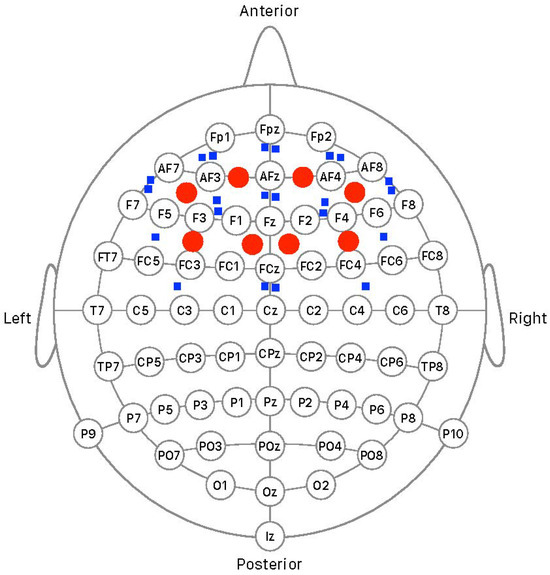 A Dual Role for the Dorsolateral Prefrontal Cortex (DLPFC) in Auditory ...