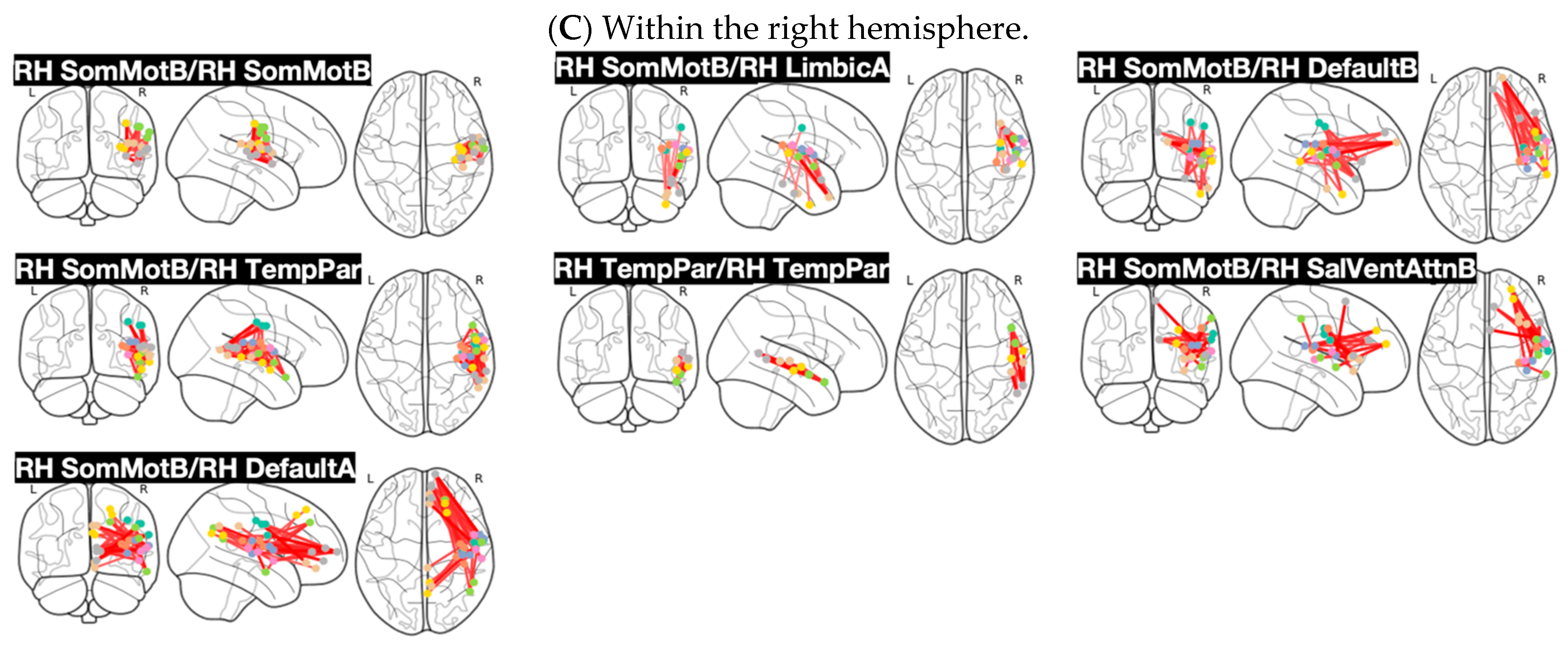 Atypical Brain Connectivity During Pragmatic and Semantic Language ...