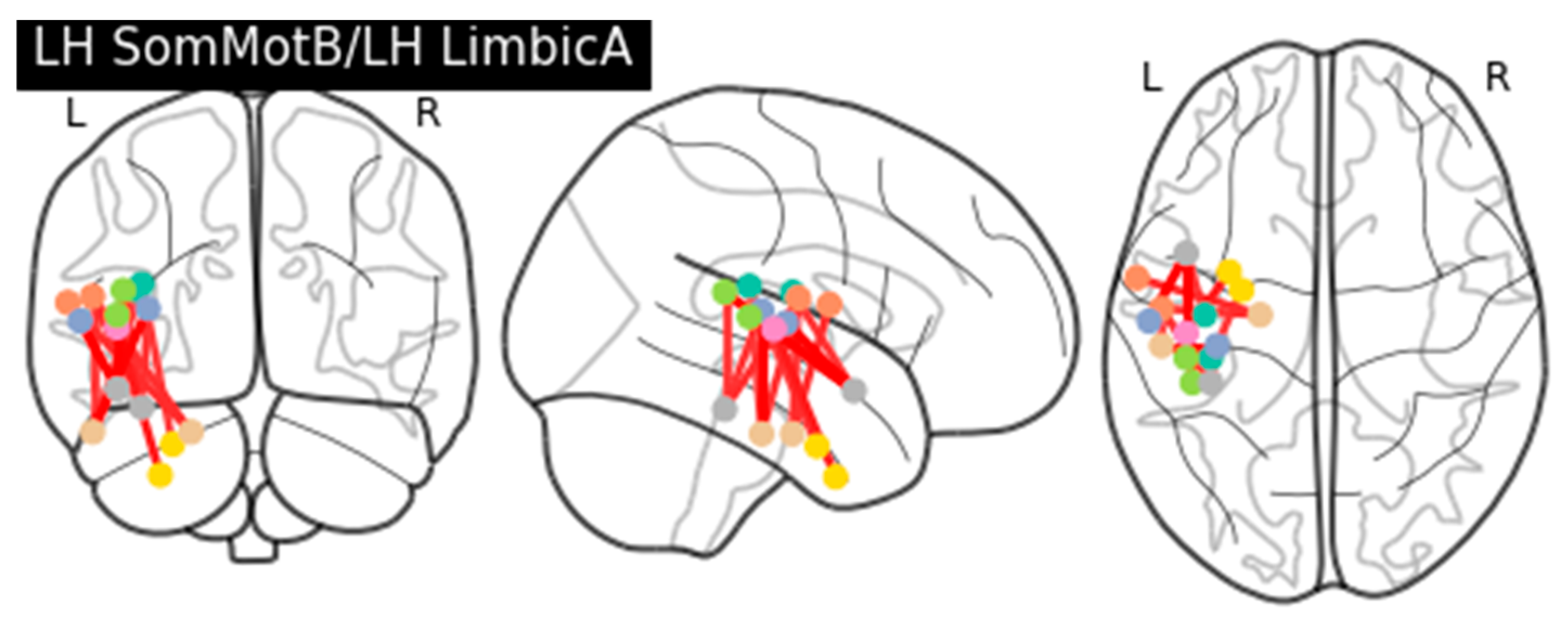 Atypical Brain Connectivity During Pragmatic and Semantic Language ...