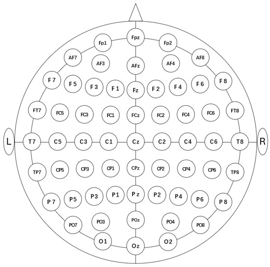 Mismatch Negativity Unveils Tone Perception Strategies and Degrees of ...
