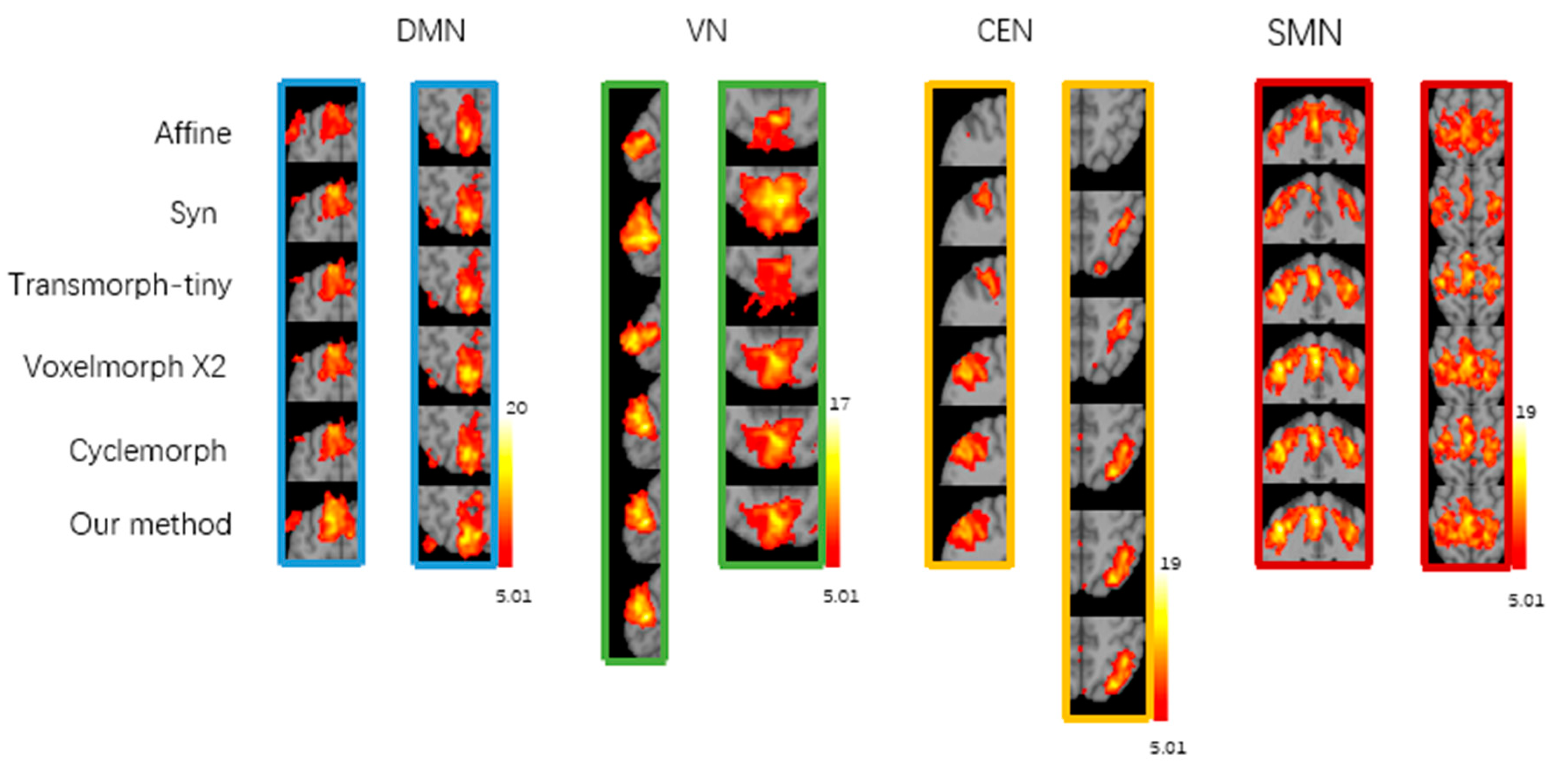 Non-Rigid Cycle Consistent Bidirectional Network with Transformer for Unsupervised Deformable ...